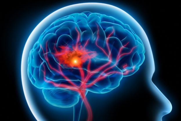 Neurological Diseases | GK Hospital